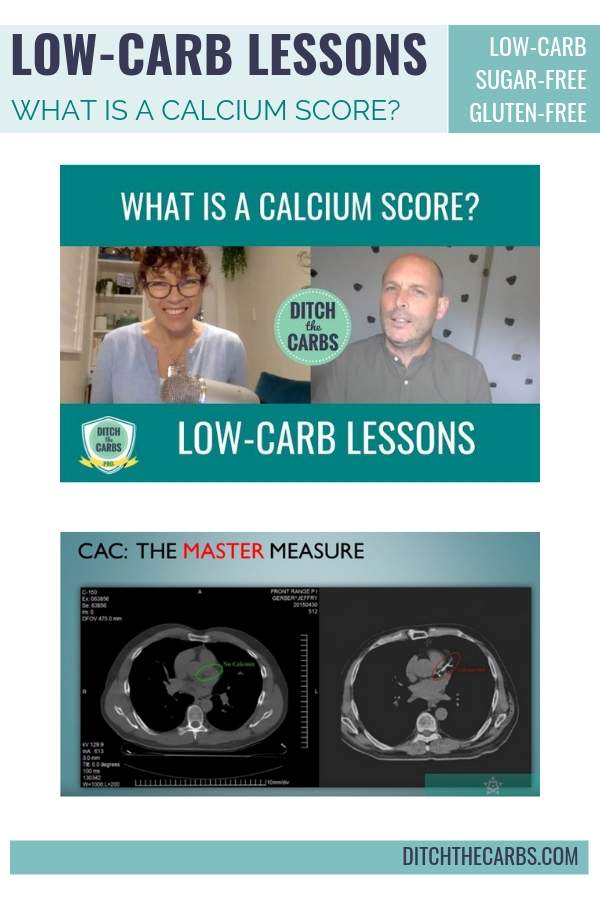 What Is A Calcium Score? (What Is Calcification?) - Thinlicious